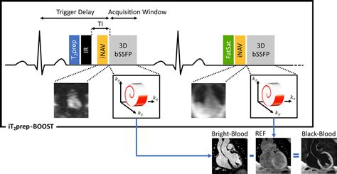 Simultaneous Inav Based 3d Whole Heart Bright Blood And Black Blood