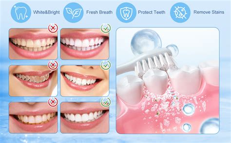 Sp 8 Probiotics Whitening Toothpaste Sp 8 Probiotic Toothpaste Fresh Breath 1