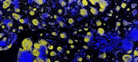 科研进展 西湖大学