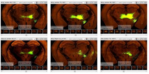Api Allen Brain Connectivity Allen Mouse Brain Connectivity Atlas