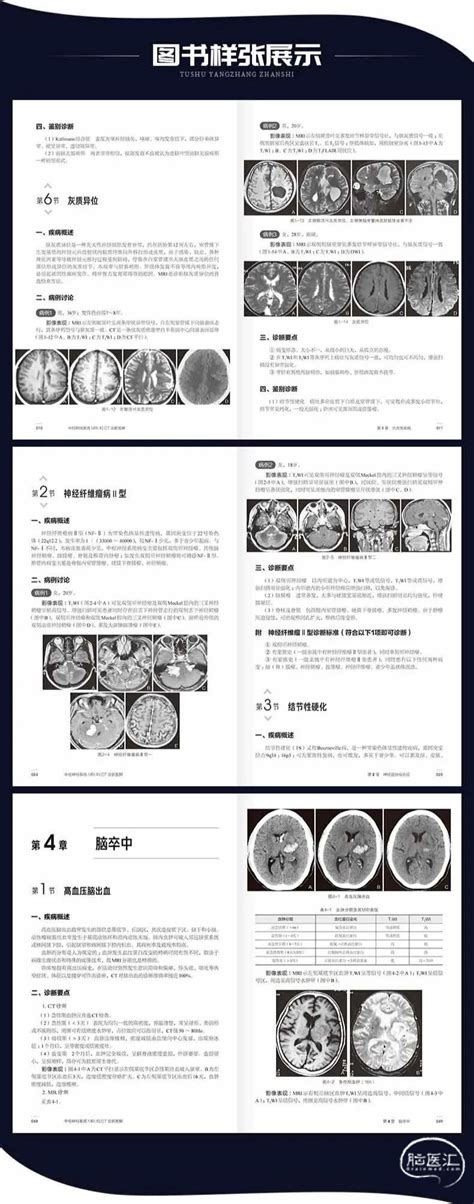 【好书推荐】《中枢神经系统mri和ct诊断图解》 脑医汇 神外资讯 神介资讯