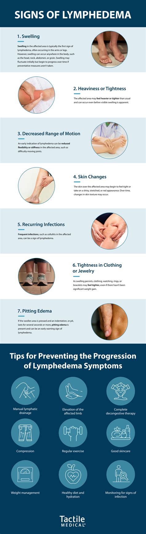 Infographic 7 Signs Of Lymphedema Tactile Medical
