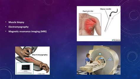 Proximal Myopathy And Causes Ppt