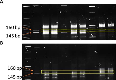 Sequencing Small Non Coding Rna From Formalin Fixed Tissues And Serum Derived Exosomes From