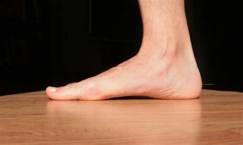 Dysfonctionnement Du Tendon Du Tibialis Postérieur Diagnostic Et Traitement