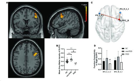 Comparisons Of Gray Matter Gm Volume As Well As Functional