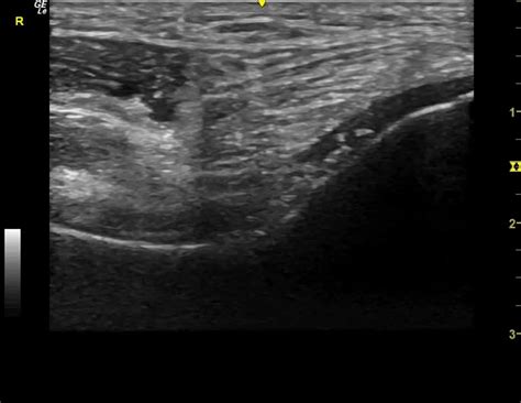 Karina Torralba On Linkedin Acrheum Ussonar Cppd