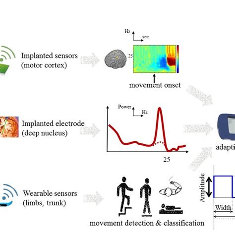 Towards Closed Loop Dbs Controlled By Neural Signals Acquired From