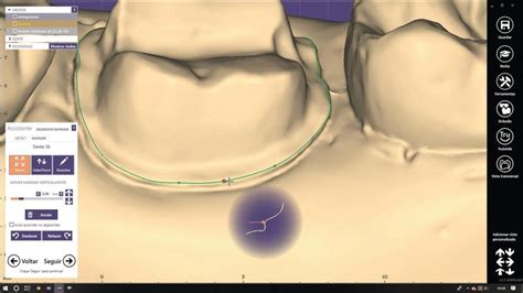 Digital Workflow In Prosthodontics Restorative Dentistry Pocket Dentistry