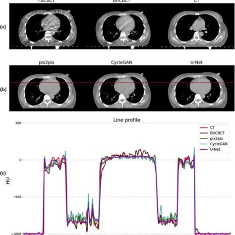 Quantitative Image Evaluation Of Cbct And Synthesized Ct Sct Images Download Scientific