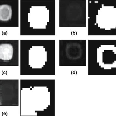Segmentation Of Various Types Of Spots Using The Kernel Density Download Scientific Diagram