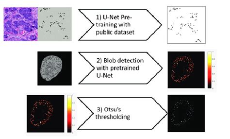 Proposed U Net With Optimal Thresholding For Small Blob Detection Download Scientific Diagram