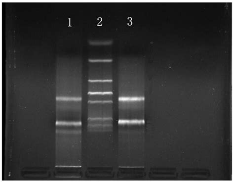 Group Of Primer Combination For Identifying Shigella Related Strains