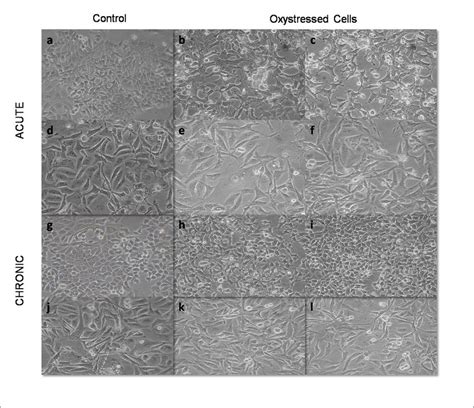 Fig S1 Morphological Assessment By Phase Contrast Microscopy Of Download Scientific Diagram