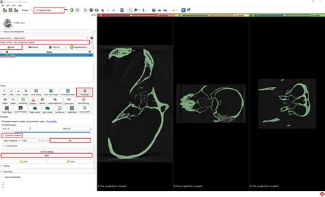cavity segmentation creating endocasts