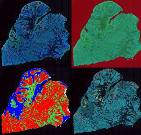 Ai Powered Pathology With Halo® Halo Ai And Halo Link 4 0 Indica Labs