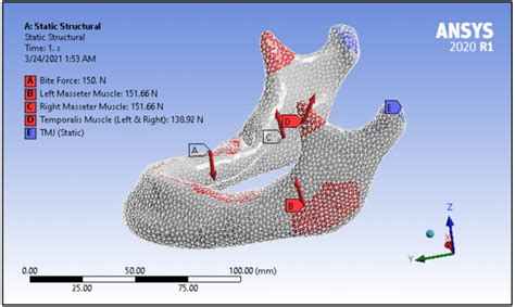 Boundary Conditions Used For Fea Download Scientific Diagram