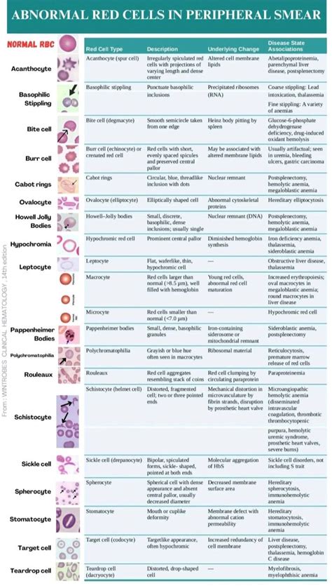 Abnormal Red Cells In Peripheral Smear Haidar Khan