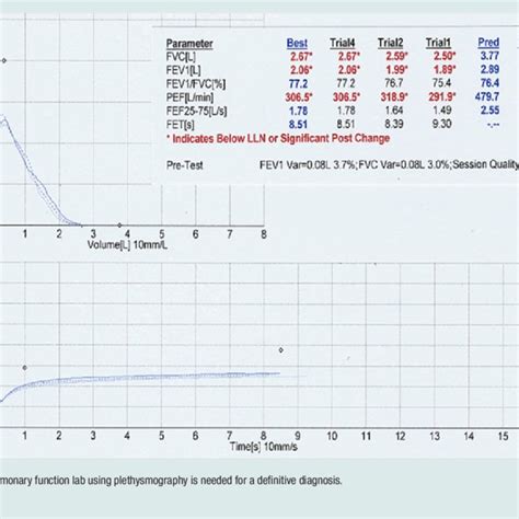 Spirometry Results Suggesting Restriction A B Download Scientific Diagram