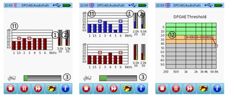 Dpoae Threshold · Pathme Ua