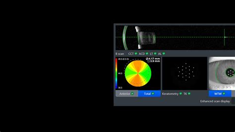 Astigmatism Visualization And Precise Measurement