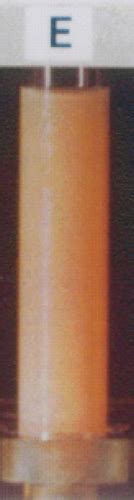 Lipids And Lipoproteins Flashcards Quizlet