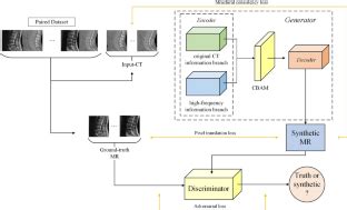 A Novel Structure Preserving Generative Adversarial Network For Ct To Mr Modality Translation Of