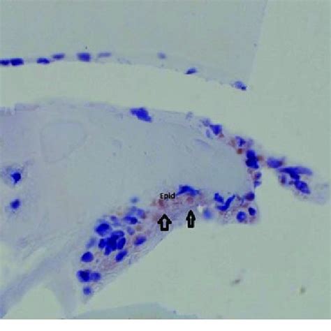 Lumpy Skin Disease Virus Particles Arrows Seen Under Electron Download Scientific Diagram