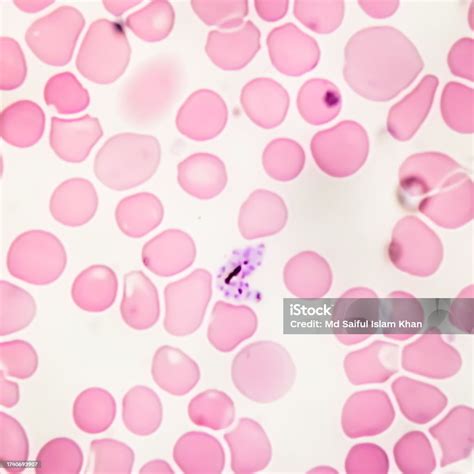 Plasmodium Vivax In Thin Film Under Microscopy Malaria Disease P Vivax