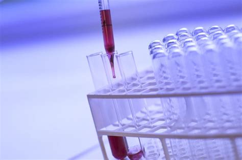 Biomarker Analysis And Assay Alera Labs Llc