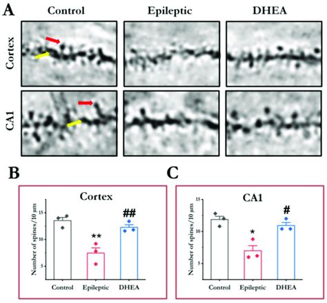 Morphological Analysis Of Dendritic Spines In The Cortex And Download Scientific Diagram
