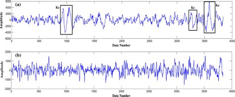 Example Eeg Signals With Without Kc A An Example Epoch With K Complex