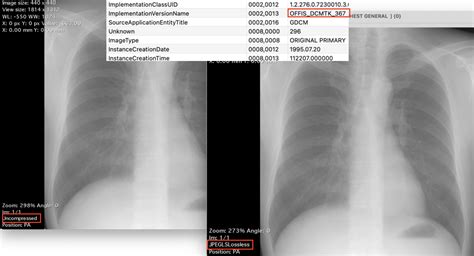 DCMTK Ver PHORLIX Blog