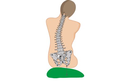 Pelvic Obliquity Causes Symptoms And Treatments Vivid Care