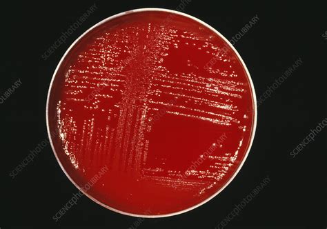 Cultured Listeria Bacteria Stock Image M8740547 Science Photo