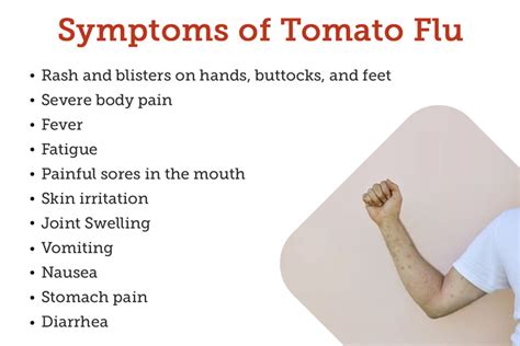 Tomato Flu Symptoms Causes Treatment And Cost