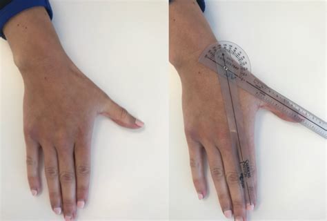 Hand Abduction And Adduction Hand And Wrist Anatomy Midwest