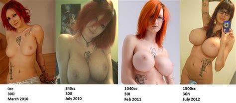 Foto De Ariane Saint Amour Progression Of Breast Implants Im Not A Shill And Have Nothing To