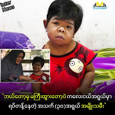 အသက် ၃၀ ရှိပြီတဲ့… တကယ့်ကလေးလေးလိုပဲ။ မိသားစုတွေကလည်း သိပ်ချစ်ကြတာပဲ