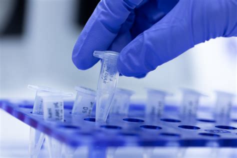 Lifecodes Donor Specific Assays Dsas Antibody Testing Portfolio