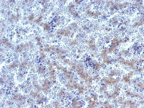 Glypican 3 Gpc3 Hepatocellular Carcinoma Marker Polyclonal Antibody