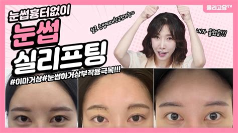 눈썹 흉터없이 쫙 올려주는 눈썹 실리프팅 실사례 Youtube