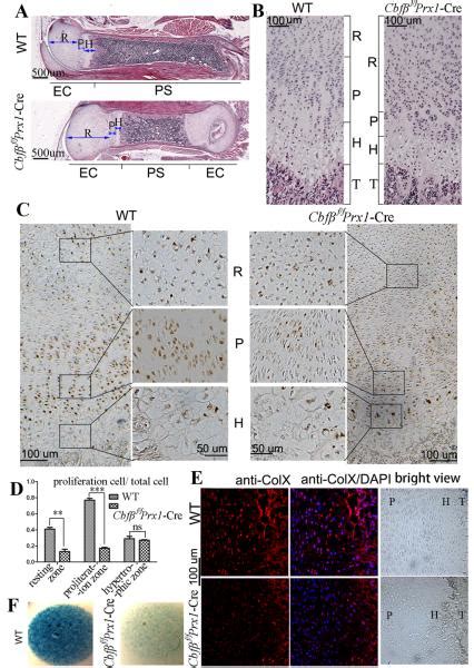 Core Binding Factor Beta Cbfβ Controls The Balance Of Chondrocyte Proliferation And