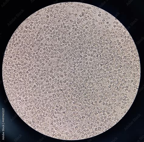 Sperm Morphology Semen Photo Under Microscope Micrograph Showing