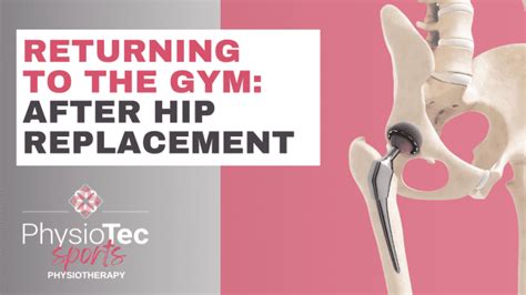 Returning To The Gym After Hip Replacement