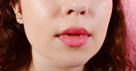 Pimples On Chin Causes Treatments And Prevention Tips