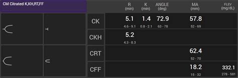 Thrombelastogram Teg Trauma Icu