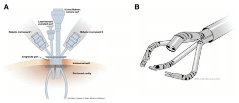 Demonstration Of Single Site Versus Single Port A Single Site Download Scientific Diagram