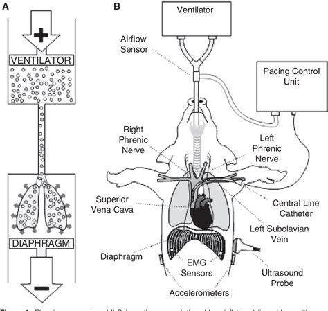 Figure 1 From Mitigation Of Ventilator‐induced Diaphragm Atrophy By Transvenous Phrenic Nerve