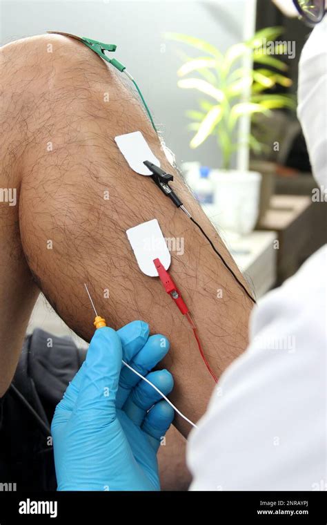 Electromyography Emg And Somatosensory Evoked Potential Pev Of Lower